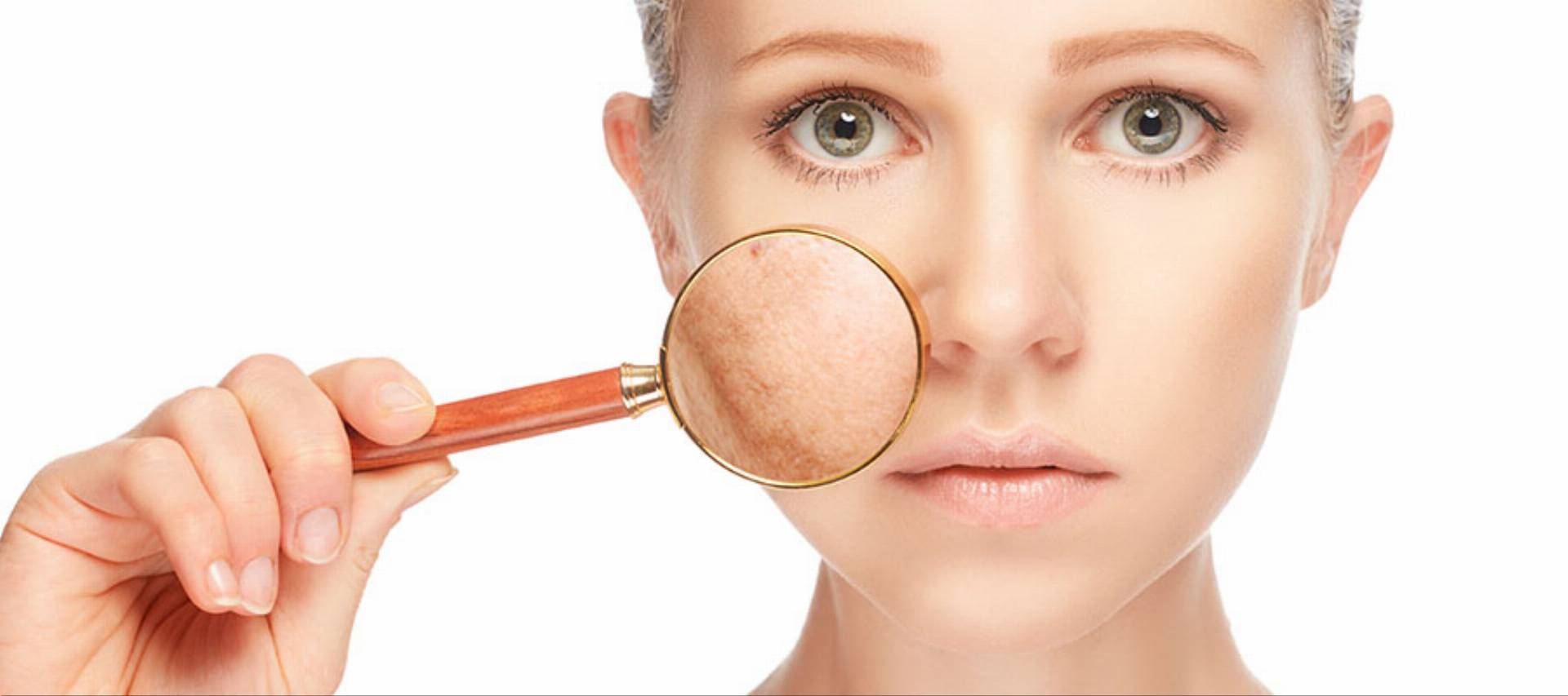 Cuáles son las características de la Resequedad de la piel y cómo ...